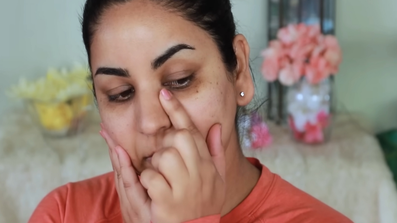 Fleke na koži - Zašto se pojavljuju i kako ih se rešiti - Viva By Ela ...